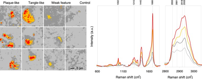 Hyperspectral Raman imaging of neuritic plaques and neurofibrillary ...