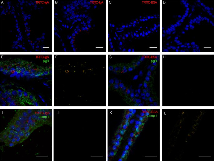 The origin of prostate gland-secreted IgA and IgG | Scientific Reports