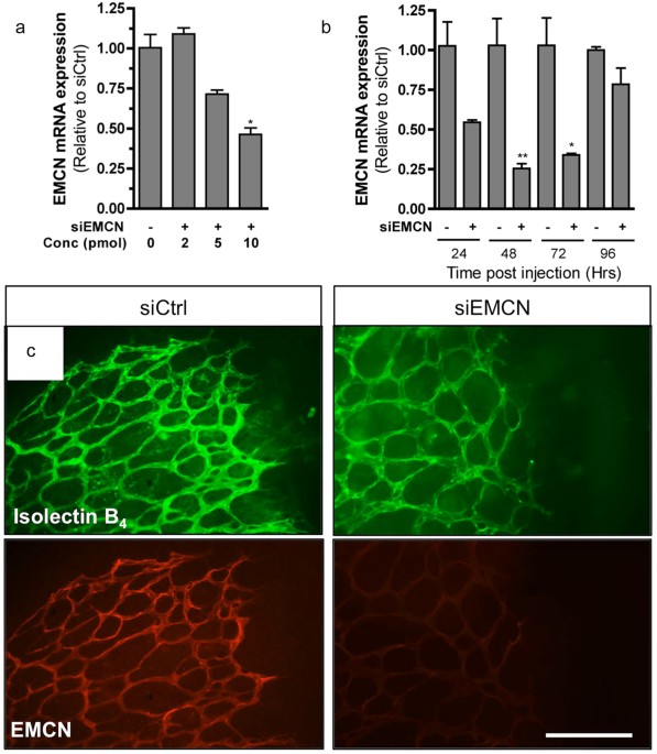 Endomucin inhibits VEGF-induced endothelial cell migration, growth, and ...