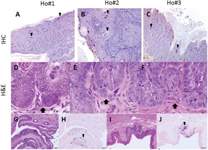 Mouse papillomavirus infection persists in mucosal tissues of an ...
