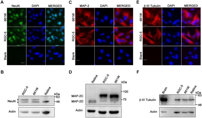 661W is a retinal ganglion precursor-like cell line in which glaucoma ...