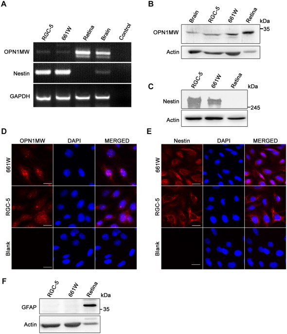 661W is a retinal ganglion precursor-like cell line in which glaucoma ...
