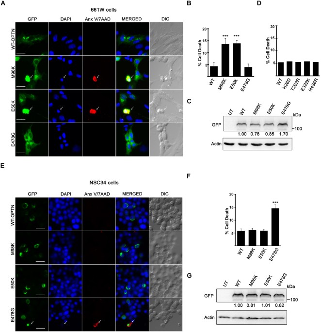 661W is a retinal ganglion precursor-like cell line in which glaucoma ...