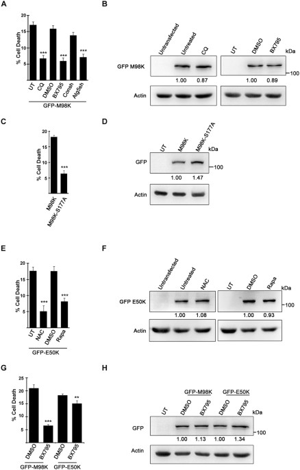 661W is a retinal ganglion precursor-like cell line in which glaucoma ...