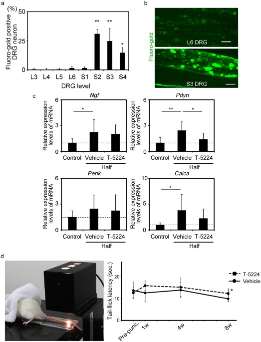 A selective inhibition of c-Fos/activator protein-1 as a potential ...