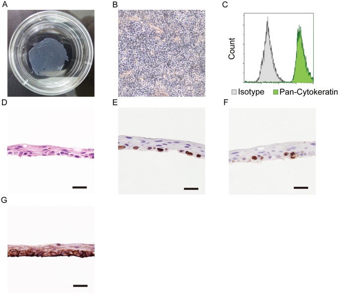 Oral epithelial cell sheets engraftment for esophageal strictures after ...
