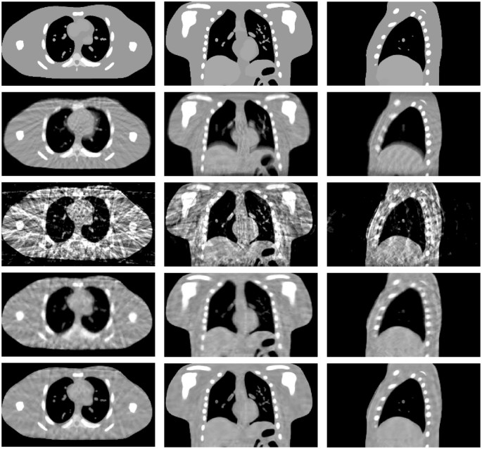 Motion guided Spatiotemporal Sparsity for high quality 4D-CBCT ...