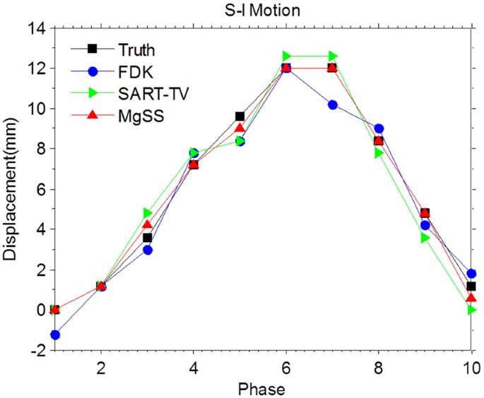 Motion guided Spatiotemporal Sparsity for high quality 4D-CBCT reconstruction | Scientific Reports