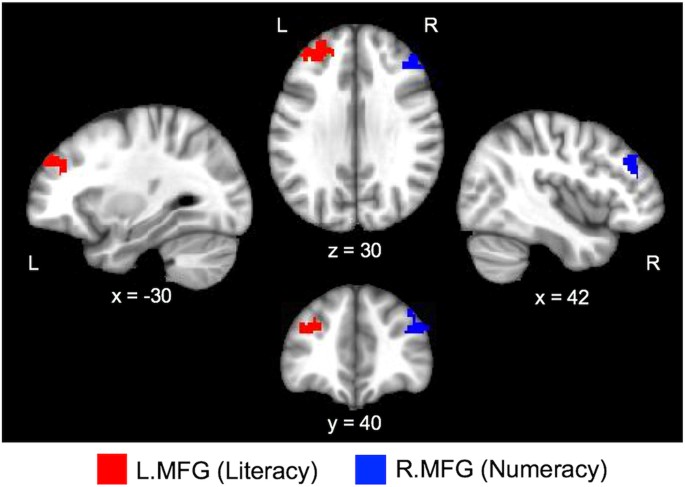 Differential contributions of the middle frontal gyrus functional ...