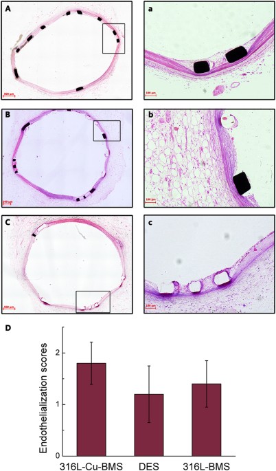 Evaluation of promoting effect of a novel Cu-bearing metal stent on ...