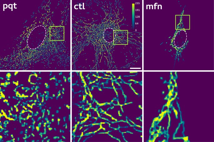 Mitochondrial network complexity emerges from fission/fusion dynamics ...
