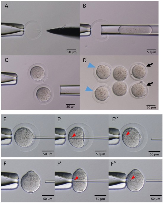 Agarose capsules as new tools for protecting denuded mouse oocytes ...