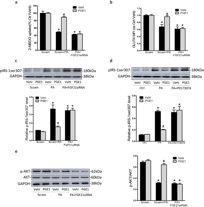 Inhibition of insulin resistance by PGE1 via autophagy-dependent FGF21 ...