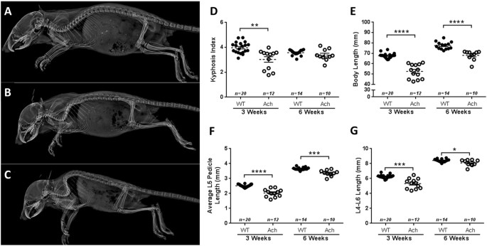 Skeletal Characterization of the Fgfr3 Mouse Model of Achondroplasia ...