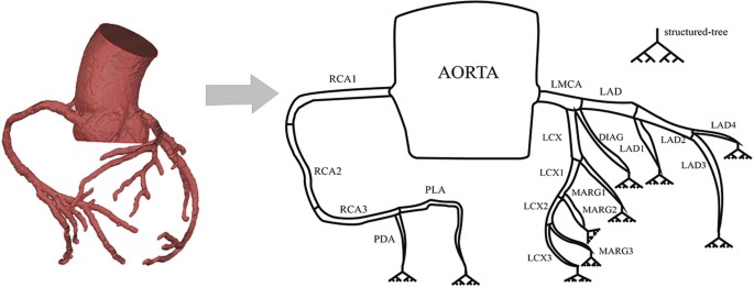 A patient-specific lumped-parameter model of coronary circulation ...