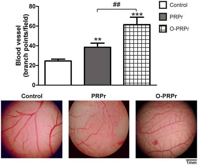 An optimised protocol for platelet-rich plasma preparation to improve ...