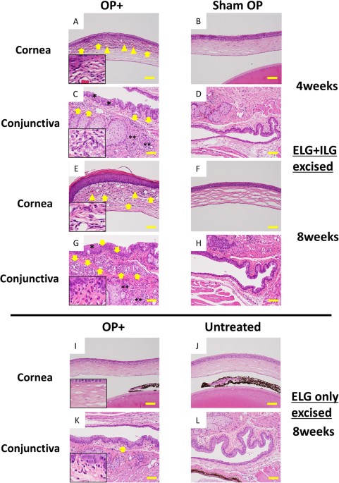 A new dry eye mouse model produced by exorbital and intraorbital ...