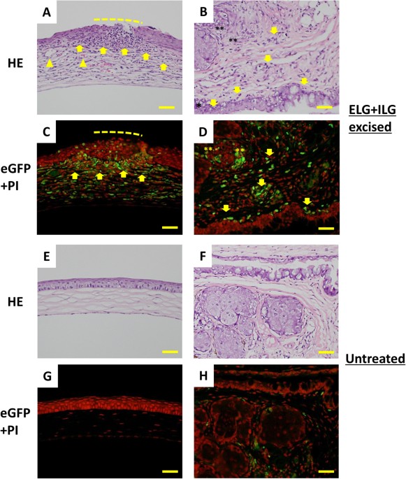 A new dry eye mouse model produced by exorbital and intraorbital ...
