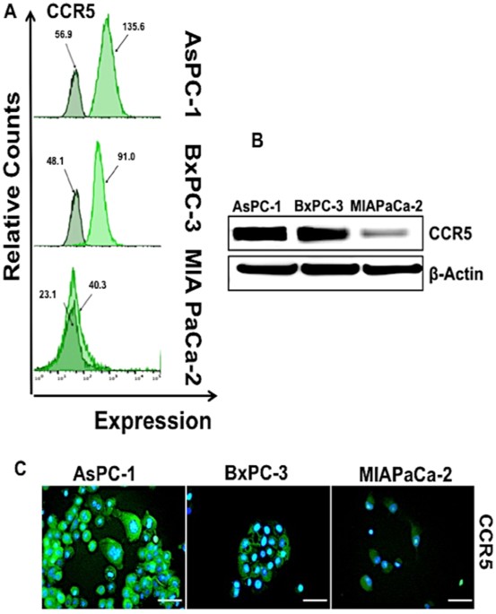 CCR5/CCL5 axis interaction promotes migratory and invasiveness of ...