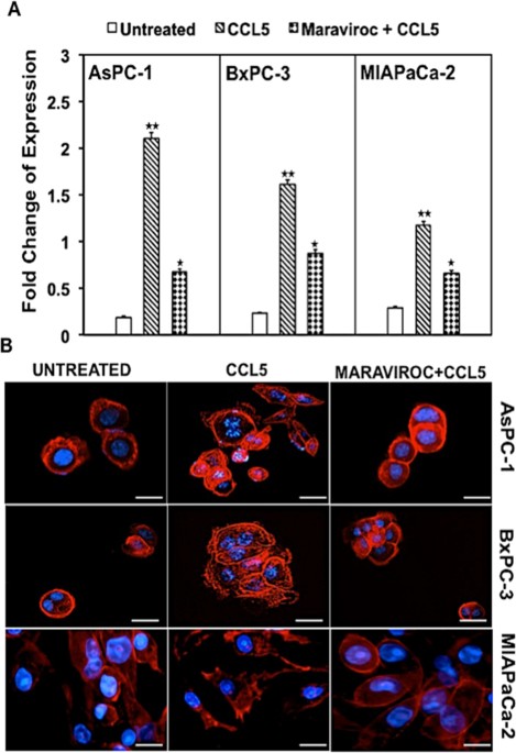 Ccr5 Ccl5 Axis Interaction Promotes Migratory And Invasiveness Of