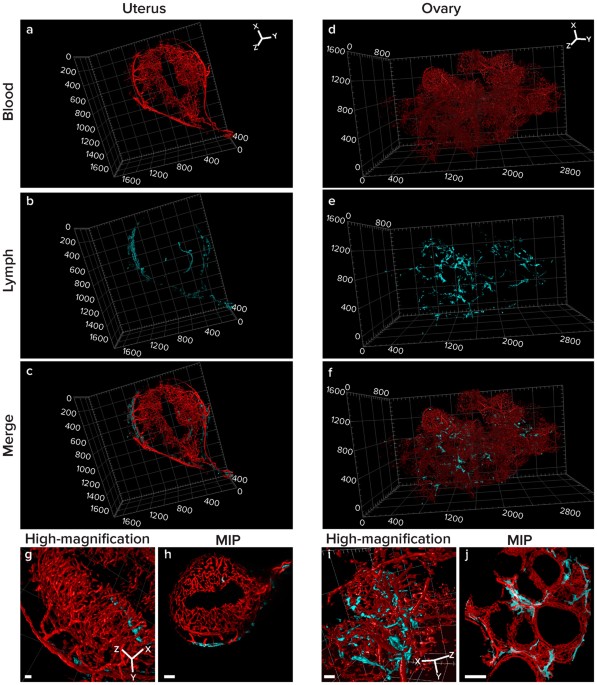 Whole Organ Blood and Lymphatic Vessels Imaging (WOBLI) | Scientific ...