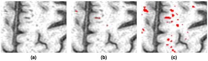 Perivascular Spaces Segmentation in Brain MRI Using Optimal 3D ...