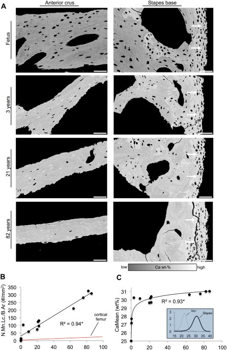 Early bone tissue aging in human auditory ossicles is accompanied by ...