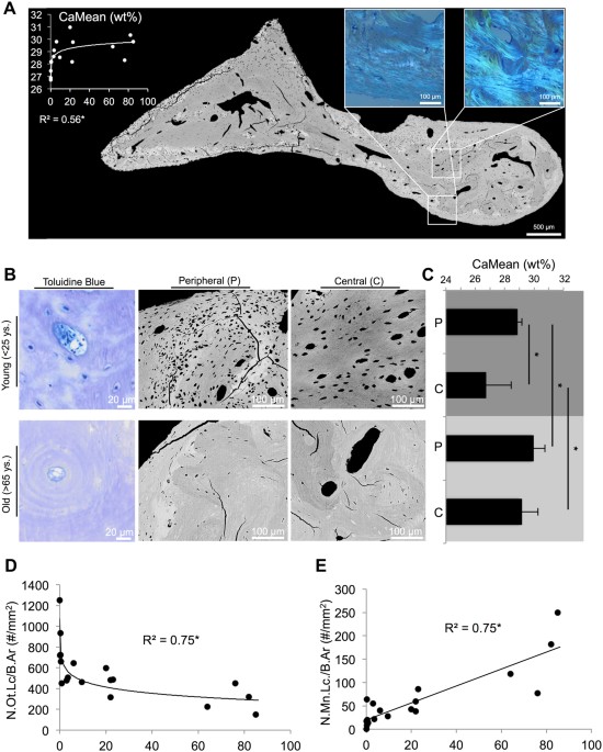 Early bone tissue aging in human auditory ossicles is accompanied by ...