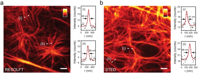 Novel reversibly switchable fluorescent proteins for RESOLFT and STED ...