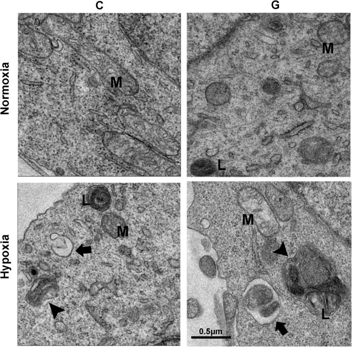 Involvement of impaired autophagy and mitophagy in Neuro-2a cell damage ...