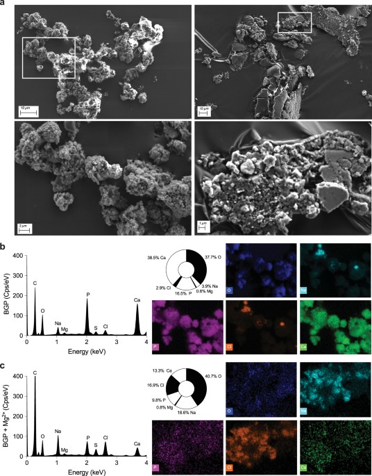 Magnesium prevents vascular calcification in vitro by inhibition of ...