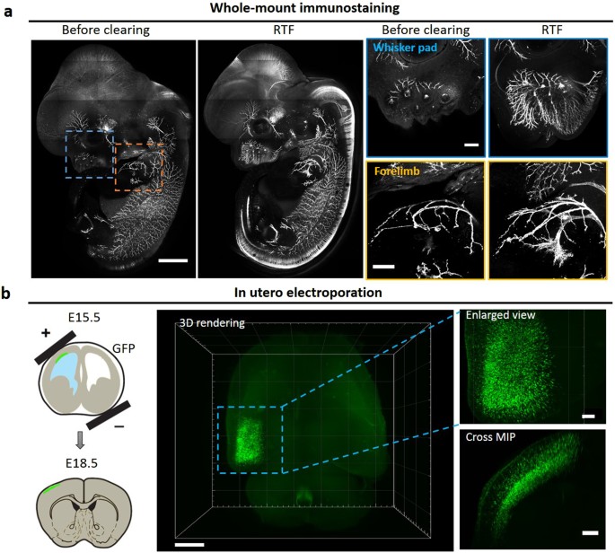 RTF: a rapid and versatile tissue optical clearing method | Scientific ...