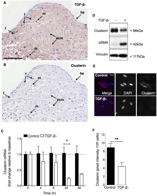 Diverse functions of clusterin promote and protect against the ...