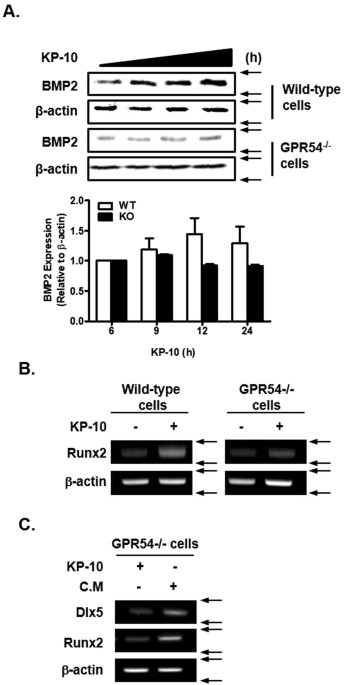 Kisspeptin 10 Kp 10 Stimulates Osteoblast Differentiation Through
