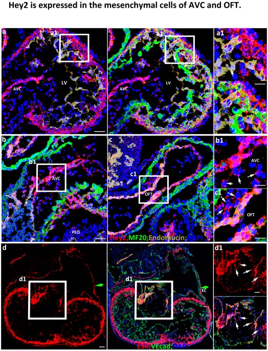 Notch signaling regulates Hey2 expression in a spatiotemporal dependent ...