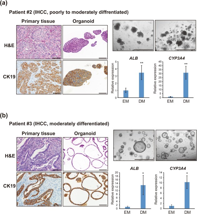 Induction Of Differentiation Cancer at Ralph Bracy blog