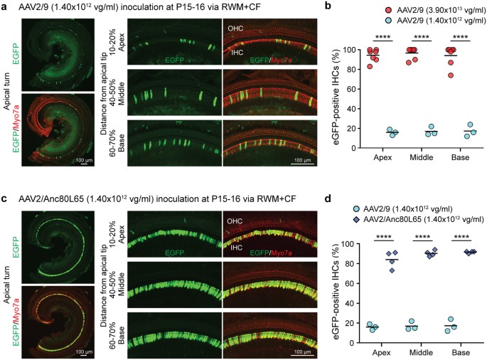Enhanced viral-mediated cochlear gene delivery in adult mice by ...