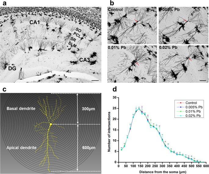 Low-level Gestational Lead Exposure Alters Dendritic Spine Plasticity ...