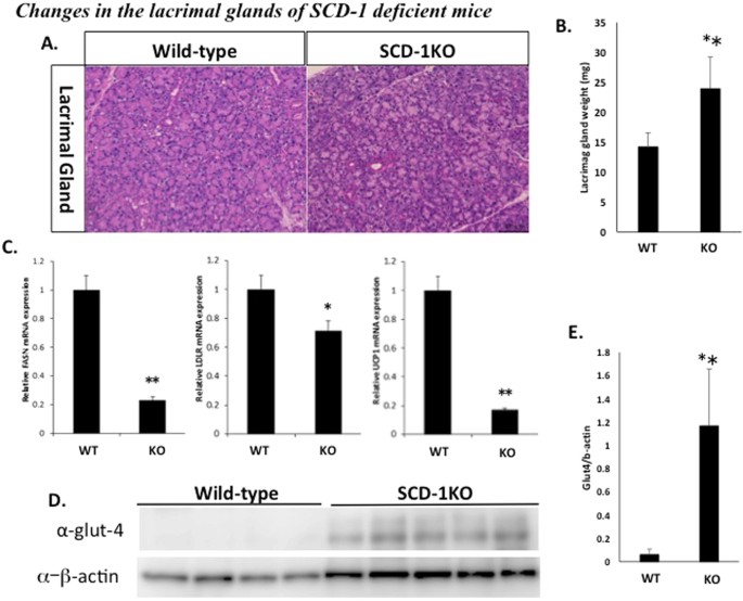 Compensatory increases in tear volume and mucin levels associated with ...