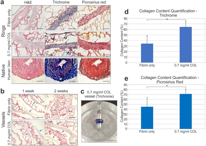 Self-assembled Collagen-Fibrin Hydrogel Reinforces Tissue Engineered ...