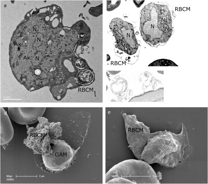 Sequential Membrane Rupture and Vesiculation during Plasmodium berghei ...