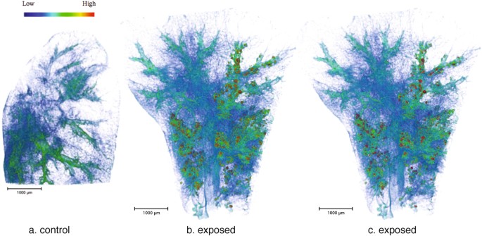Multi-scale X-ray computed tomography to detect and localize metal-based nanomaterials in lung ...
