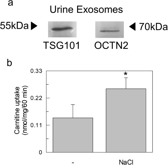 Characterization of Exosomal SLC22A5 (OCTN2) carnitine transporter ...