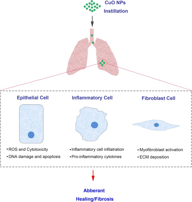 Intranasal Delivery Of Copper Oxide Nanoparticles Induces Pulmonary
