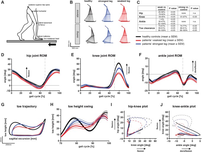 Profiling walking dysfunction in multiple sclerosis: characterisation ...