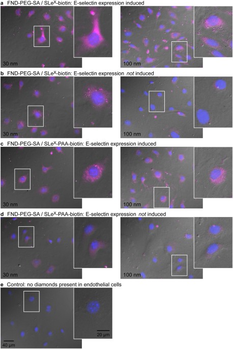 Reduced background autofluorescence for cell imaging using nanodiamonds ...