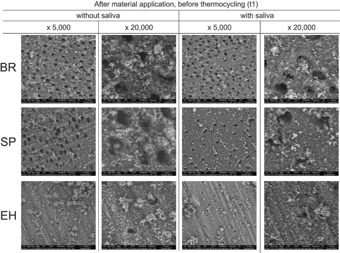 In vitro effects of hydroxyapatite containing toothpastes on dentin ...