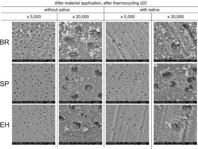In vitro effects of hydroxyapatite containing toothpastes on dentin ...