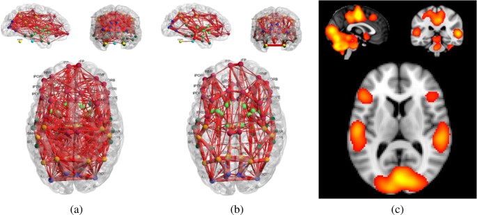 Function Specific And Enhanced Brain Structural Connectivity Mapping