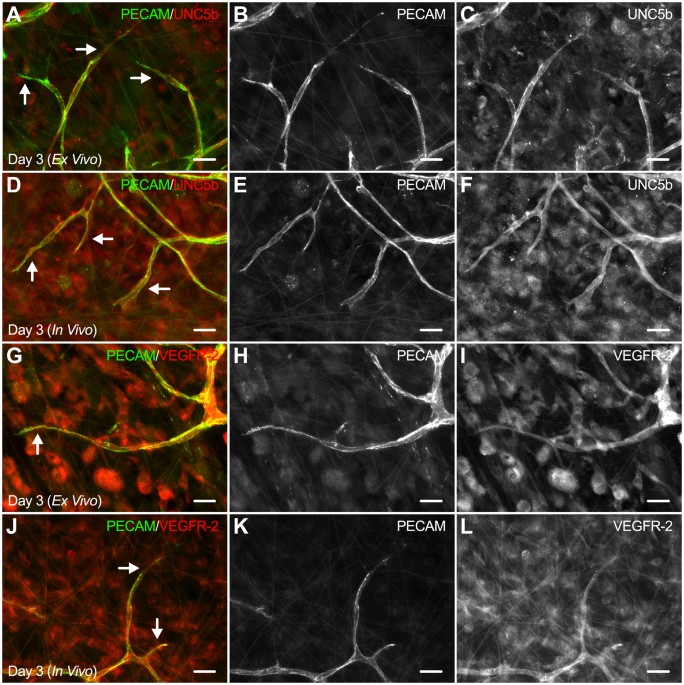 Endothelial Cell Phenotypes are Maintained During Angiogenesis in ...